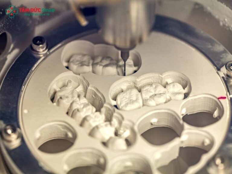 Prosthodontics: Dental Prosthetics, Implants, Crowns, Dentures